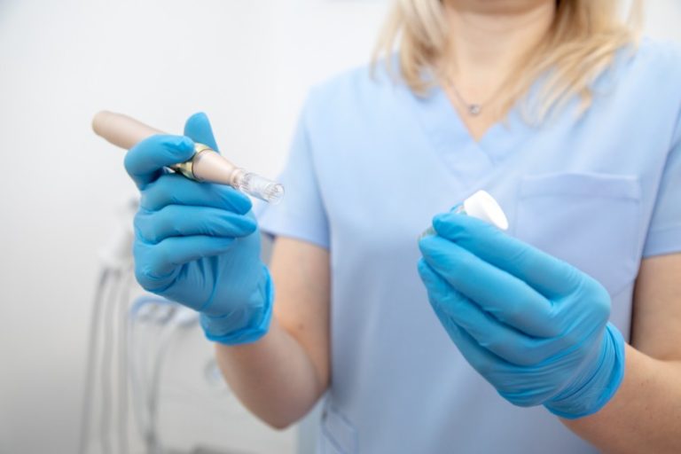 Microneedling For Stretch Marks A Minimally Invasive Treatment
